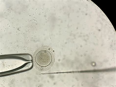 View At Human Sperm Under Microscope In Lab Stock Image Image Of Clinic Procedure 155140187
