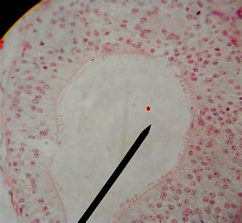 Placas Histologicas Epididimo