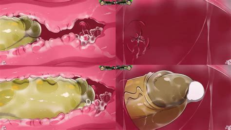 Rule 34 Cervical Penetration Cum Erect Penis Female Gmeen Huge Cock Male Penis Tagme X Ray