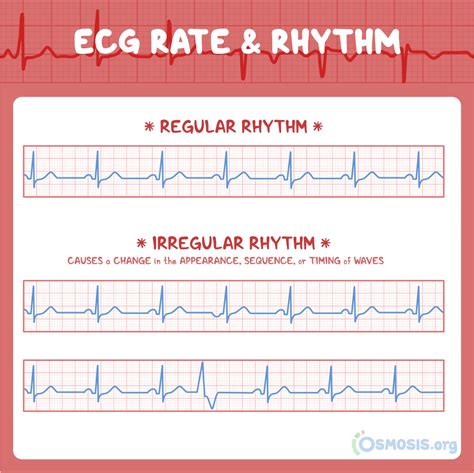 Osmosis From Elsevier Its True That Heart Disease Runs In Families But Did You Know That