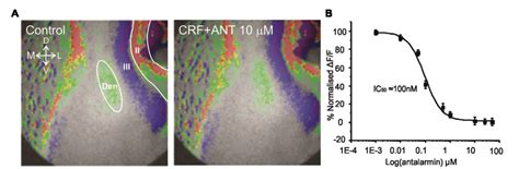 Figure 3 From Suppression Of Piriform Cortex Activity In Rat By Corticotropin Releasing Factor 1
