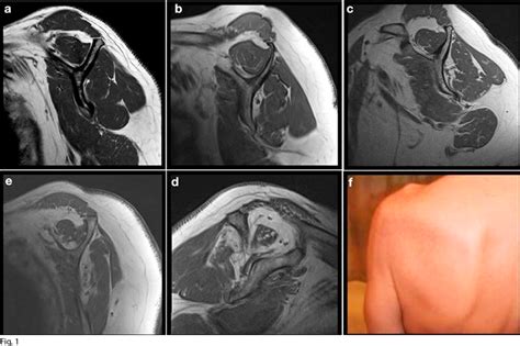 Figure 1 From Efficacy Of Imaging Modalities Assessing Fatty