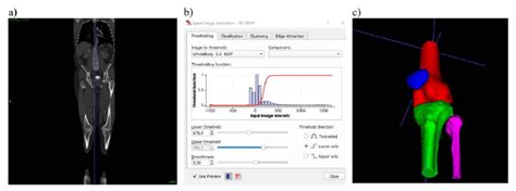 The 3d Segmentation Progression In Itk Snap A Assimilated Image Data Download Scientific