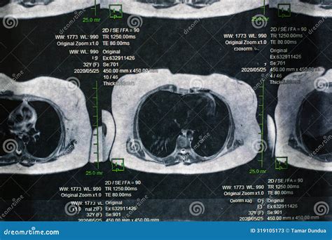 Magnetic Computer Tomography Stock Image Image Of Work Anatomy 319105173