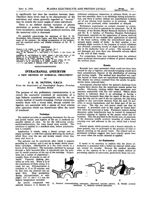 Intracranial Aneurysm Pmc