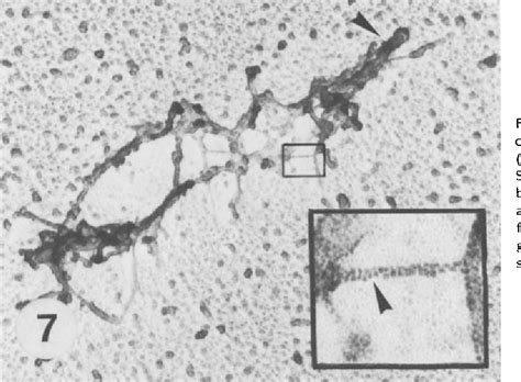 Figure 1 From Filamentous Structures In Adherent Mycoplasma Pneumoniae