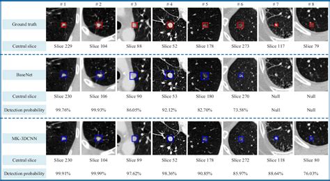 Figure 1 From Multi Kernel Driven 3d Convolutional Neural Network For