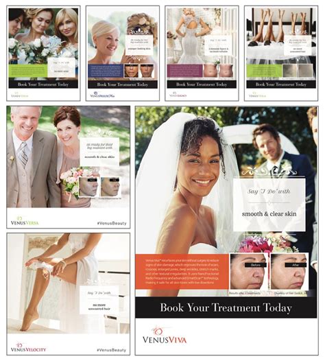 5 Ways To Use Wedding Themed Ads In Your Practice