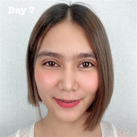 กรีดยาว Archives Doctor Garn Clinic คลินิกหมอกาญจน์ ศัลยกรรมตาสองชั้น ทำตา 2 ชั้น รีวิวกว่า