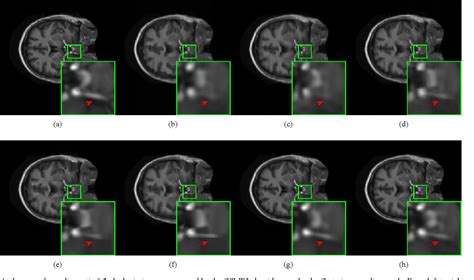 Figure 6 From Regularization By Multiple Dual Frames For Compressed