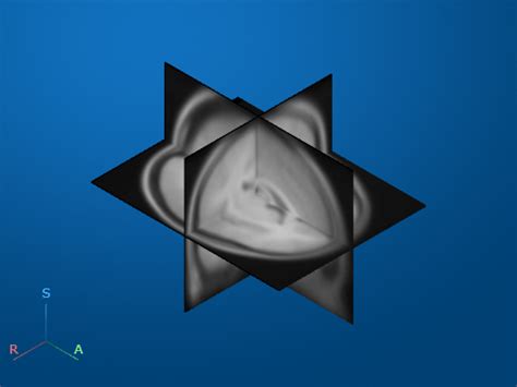 Segment And Analyze Brain Mri Scan Using Ai