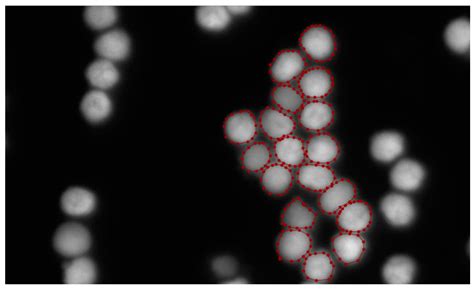 An Improved Nested U Net Network For Fluorescence In Situ Hybridization Cell Image Segmentation