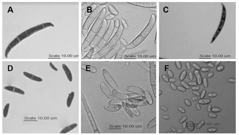 Microconidia Of Fusarium