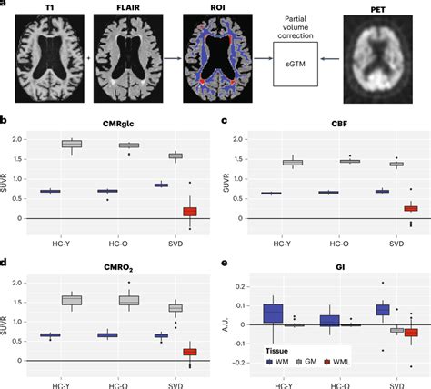 Metabolic Parameters Measured In Wm Gm And Lesion In Hc Y Hc O And