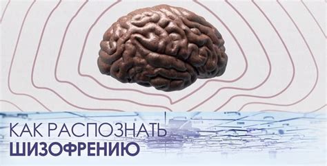 КАК РАСПОЗНАТЬ ШИЗОФРЕНИЮ Пикабу