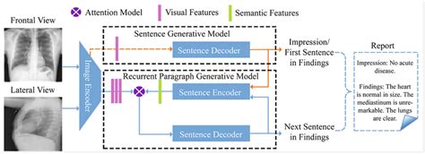 Multimodal Recurrent Model For Arrg [74] Download Scientific Diagram