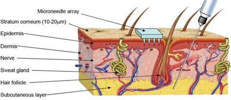 Microneedle Arrays Cellenion