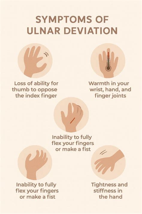 What Is Ulnar Deviation Vibrantfit Uk