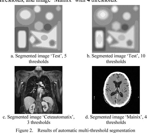 Figure 1 From Automatic Multi Threshold Image Segmentation Using Metaheuristic Algorithms