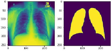 Deep Neural Network For Lung Image Segmentation On Chest X Ray