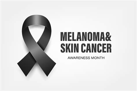 흑색종 피부암 배너 카드 흰색 배경에 벡터 3d 사실적인 블랙 리본이 있는 플래카드 흑색종 피부암 인식의 달 기호 클로즈업 5월 세계 흑색종의 날 개념 나비매듭에 대한 스톡