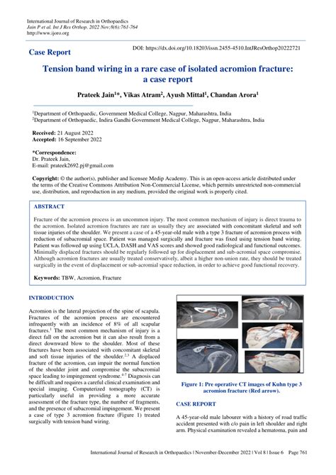 Pdf Tension Band Wiring In A Rare Case Of Isolated Acromion Fracture