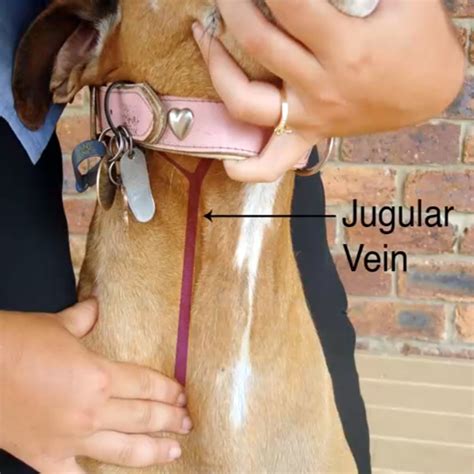 How To Place An Intravenous Catheter CCG