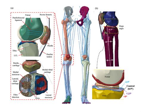 A Finite Element Musculoskeletal Model With An Intact Knee B The Download Scientific Diagram