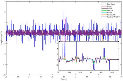 Remote Sensing Free Full Text Noise Attenuation For Csem Data Via Deep Residual Denoising