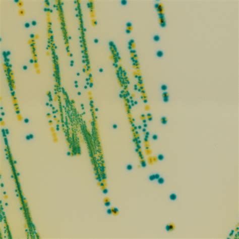 Chromagar™ Cronobacter Chromagar