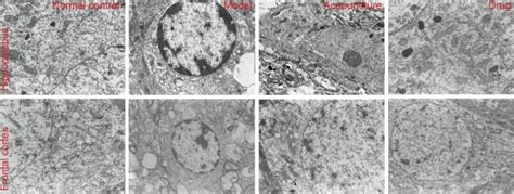 Effect Of Acupuncture On The Morphology Of Nerve Cells In The Frontal Download Scientific