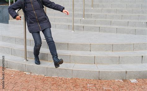 Falling Woman On Slippery Stairs Icy Steps Fell Unsafe Wet Steps