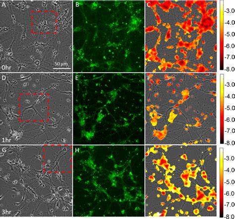 Mouse cortical neurons treated with aged nM fluor Aβ from Download Scientific Diagram