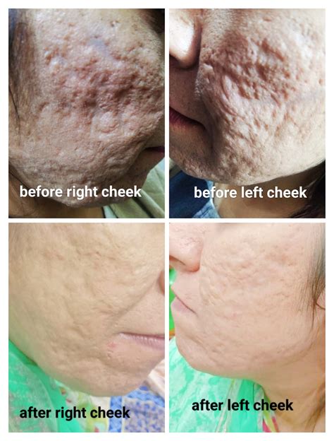 Naheed Ahmed Chaudhary