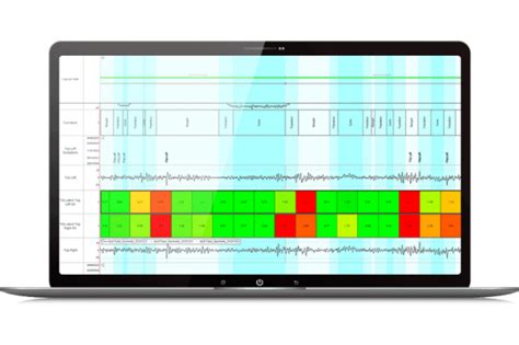 assetwise rail condition analytics software bentley systems