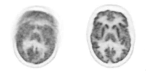 Medicalimaging Deeplearning Ai Ml Algorithms Osama Ammar Msc