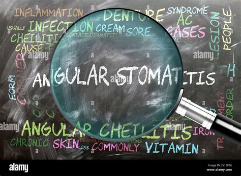 Angular Stomatitis Being Studied Examined Under Close Inspection