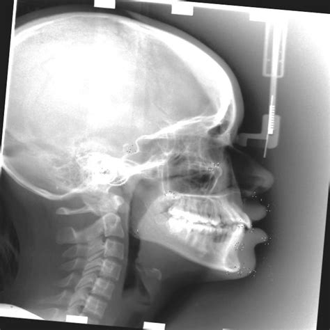 Classify And Conditionally Detect Single Label Classification