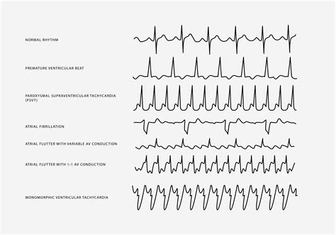 Heart Rhythm Set Vector 182818 Vector Art At Vecteezy