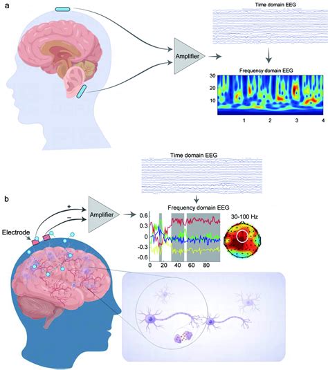 Electroencephalogram Signal Acquisition A Unipolar Lead B Bipolar Download Scientific