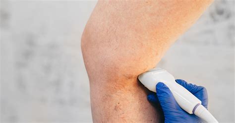 Deep Vein Thrombosis Signs Symptoms And Prevention Uvvc