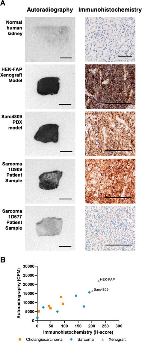 Correlation Of Fap Expression Analysis By Immunohistochemistry And Download Scientific Diagram