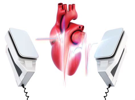 Defibrillator Sync Aed And Pacer