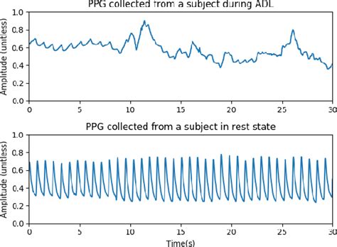Figure 1 From Motion Artifact Reduction In Photoplethysmography For Reliable Signal Selection