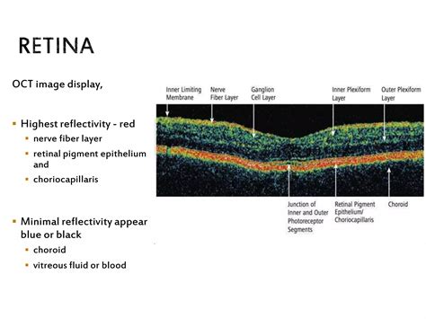 Optical Coherence Tomographyoct Macula Pptx Eye And Vision