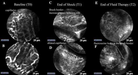 Confocal Imaging Of Bowel Perfusion A B Baseline T0 Regular Download Scientific Diagram