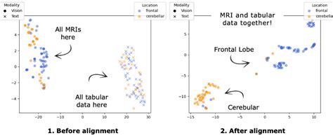 논문 리뷰 Revisiting Clip Efficient Alignment Of 3d Mri And Tabular Data