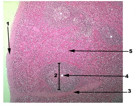 Histology Spleen 2 Diagram Quizlet