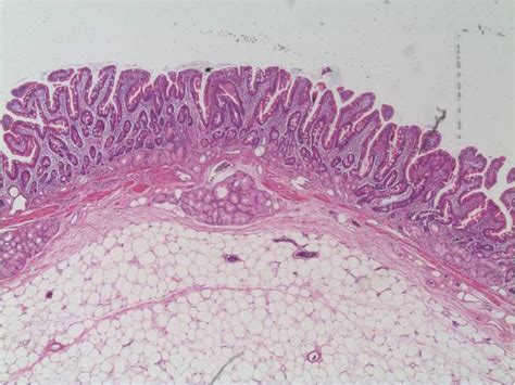 Normal Duodenum Histology