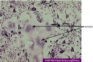 Cytopathic Effect Cpe Of Viruses Types With Examples • Microbe Online
